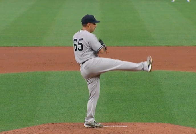 Error. Error. Error. Error. Leg Kick. KC 8 Yankees 4 - Yankee.Blue